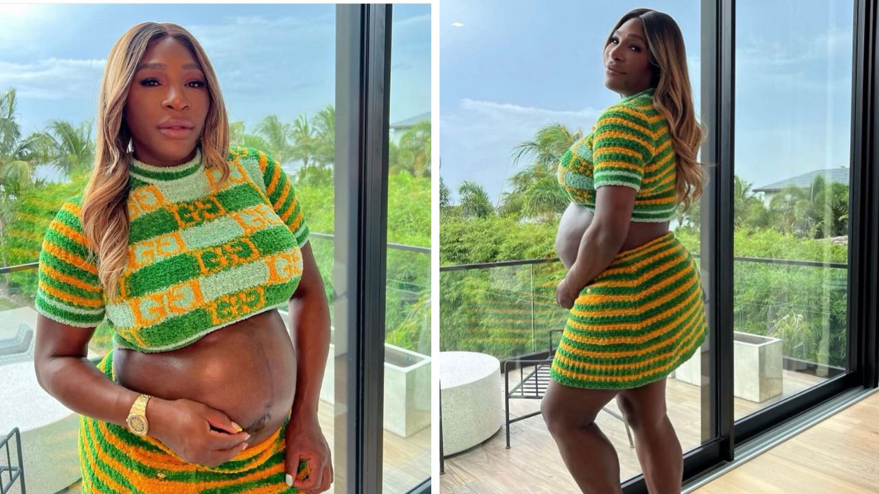 Serena Williams Flaunted Her Baby Bump in a Green and Orange Striped ...